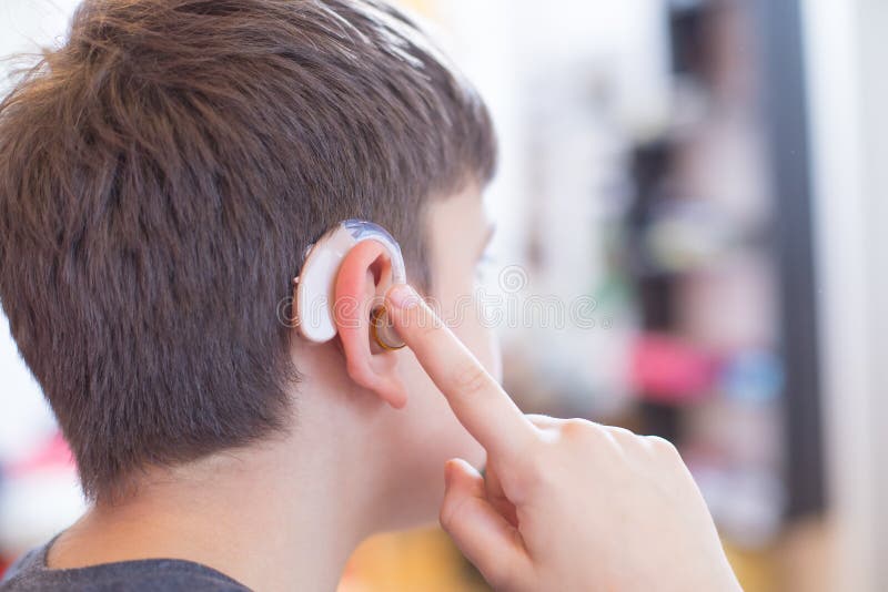Young boy with hearing aid stock image. Image of sound - 184273789