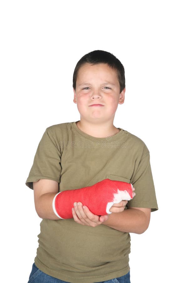 Young boy with red cast stock image. Image of childhood - 8516719