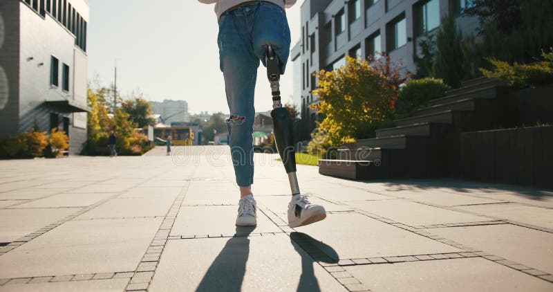 Young Woman Student with Prosthetic Leg Walking in University Campus ...