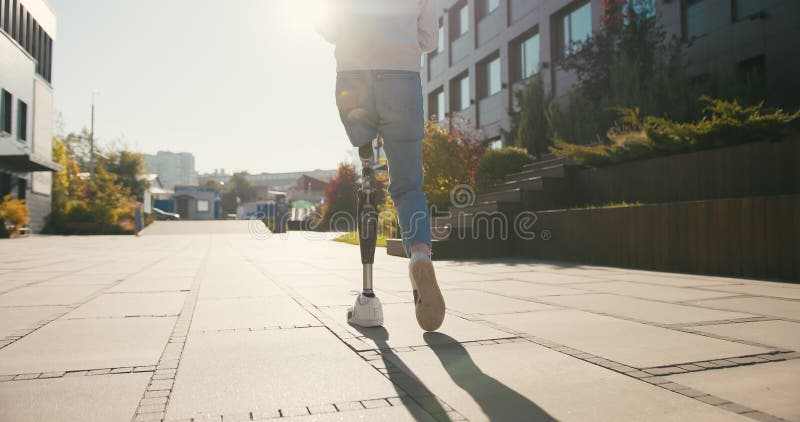 Young Woman Student with Prosthetic Leg Walking in University Campus ...