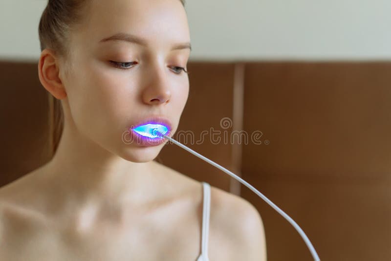 A Young Girl is Engaged in Home Teeth Whitening. Stock Image - Image of ...