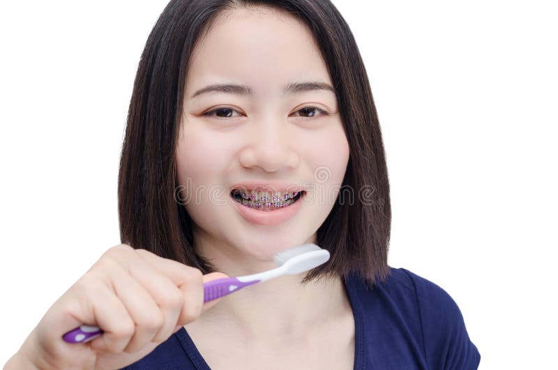 Young Girl with Teeth Brace Stock Image - Image of healthy, girl: 68303851