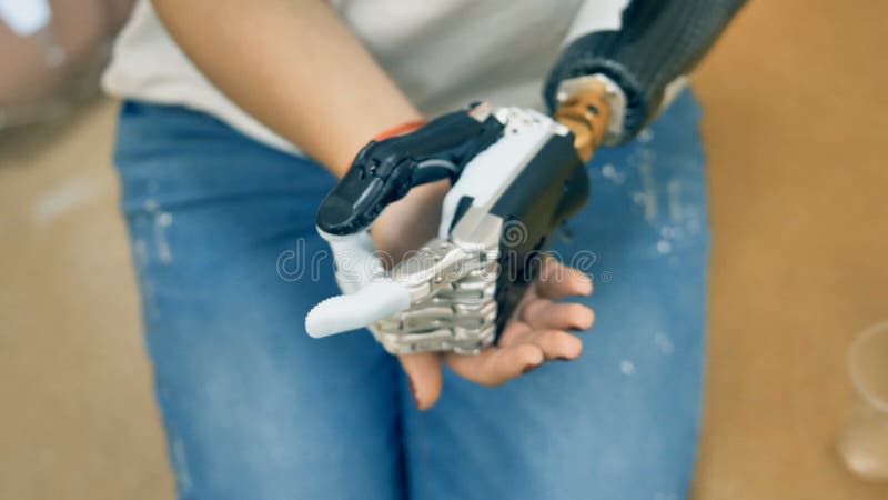 Female Using Wireless Bionic Prosthesis for the First Time. Robotic ...