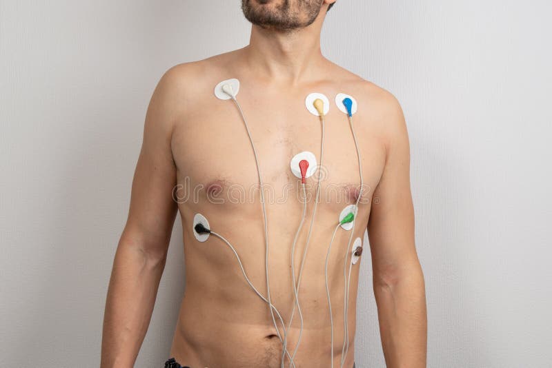 Young male body with ECG electrodes attached, Young male patient with ...