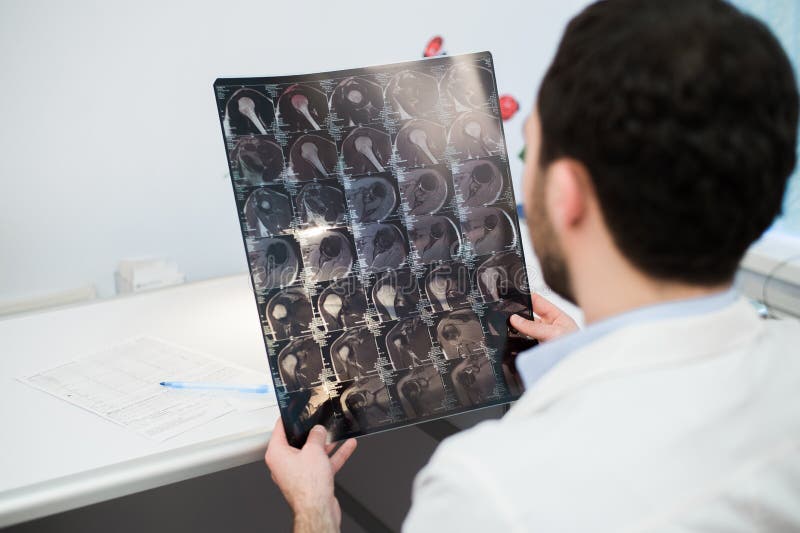 Physician Reading and Reviewing a MRI Brain Scan on Gradient Bac Stock ...