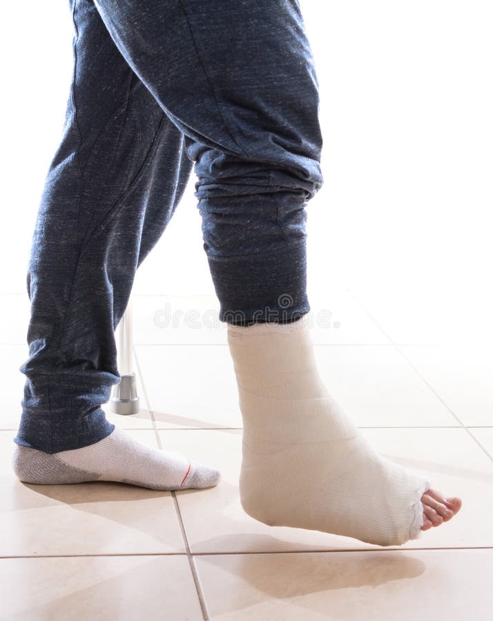 1,545 Man Leg Cast Stock Photos - Free & Royalty-Free Stock Photos from ...