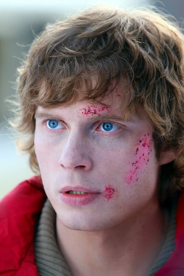 Young Man with Bruises on a Face Stock Photo - Image of misfortune ...