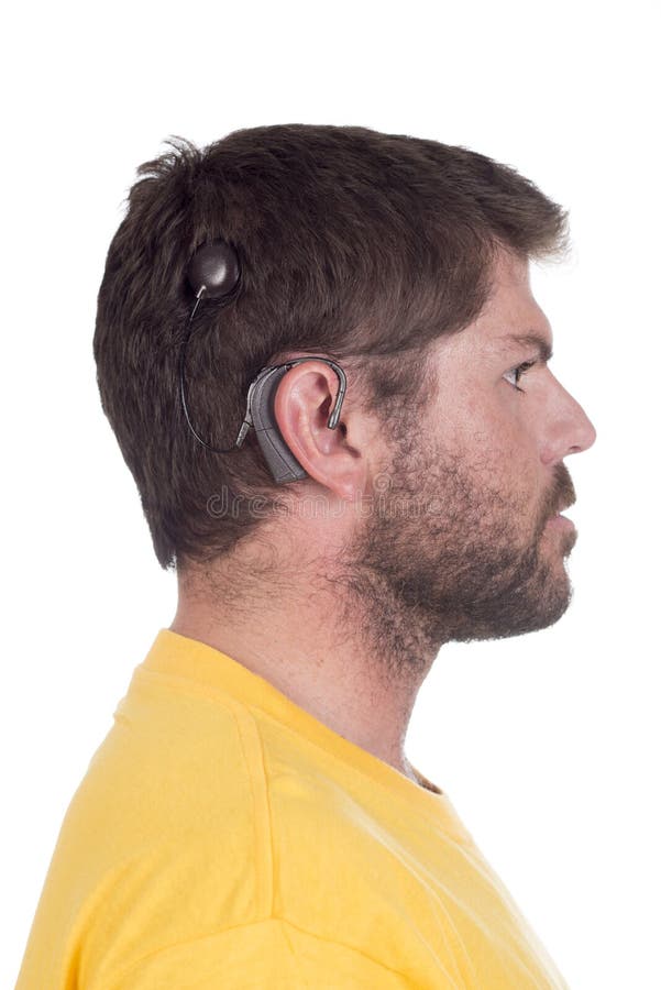 Young Man with Cochlear Implant Stock Image - Image of young, beard ...