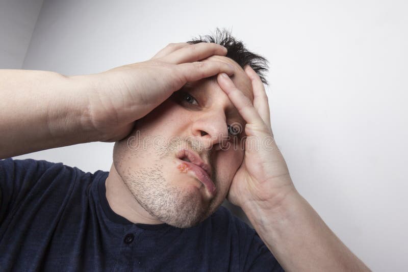 Young man with cold sore stock photo. Image of care - 194186746