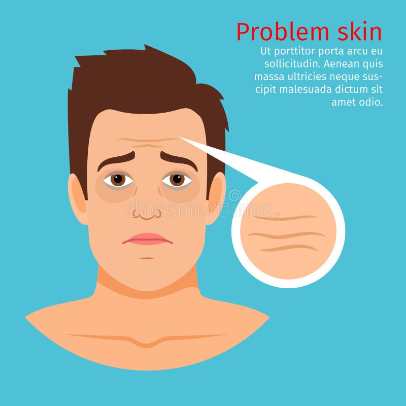 Young Man Face Problem Wrinkles Stock Vector - Illustration of ...