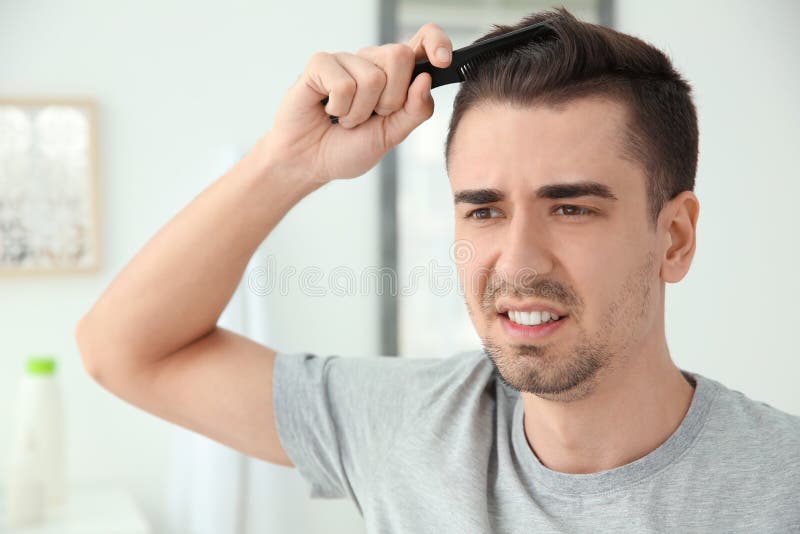 Young Man With Hair Loss Problem Picture. Image: 114513155