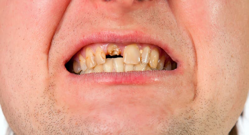 379 Disgusting Human Mouth Stock Photos - Free & Royalty-Free Stock ...