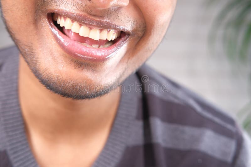 Young Man Open Mount Checking His Teeth Stock Image - Image of face ...