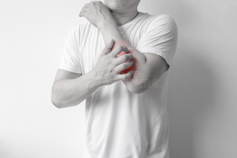 Man Scratch the Itch with Hand Stock Photo - Image of rash, dermatitis ...
