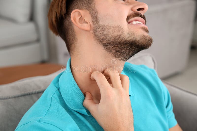Young Man Scratching Neck. Annoying Itch Stock Photo - Image of hygiene ...