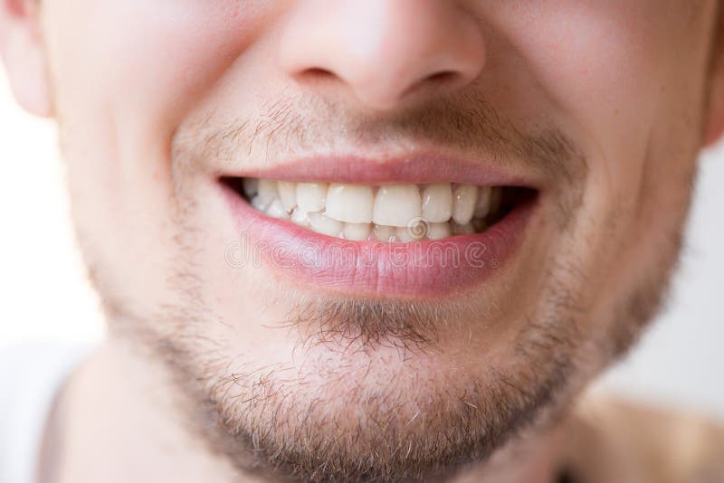 Young Man Smiles in the Camera: White Teeth, Lips and Beard Stock Photo ...