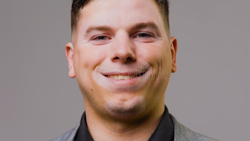 Young Man in the Studio Smiling Broadly Looking at the Camera Vitiligo ...