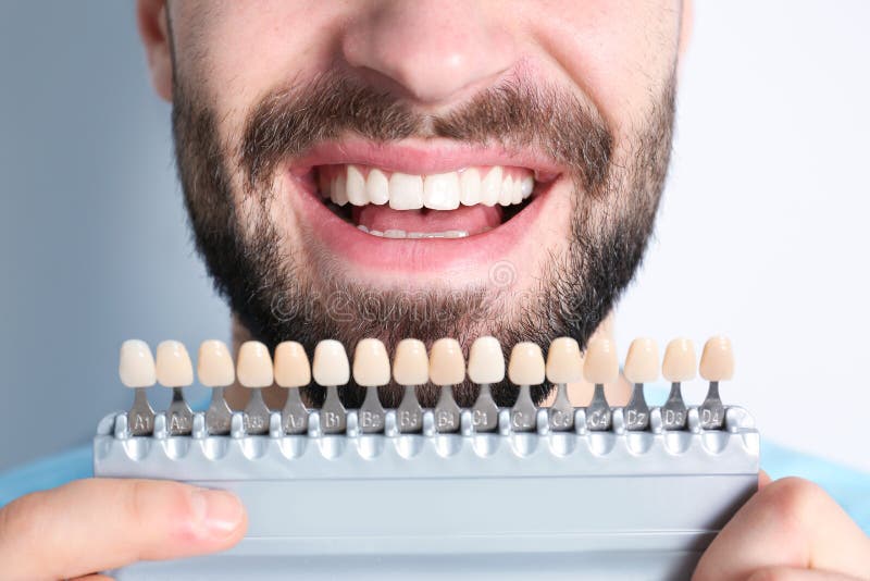 Young Man with Teeth Color Samples on Light Background Stock Image ...