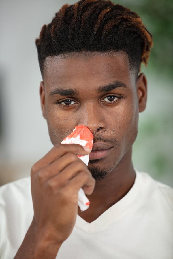 Young Man Touching Bleeding Nose Stock Photo - Image of chronic ...
