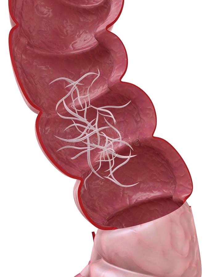 Young pinworms stock illustration. Illustration of digestive - 5604846