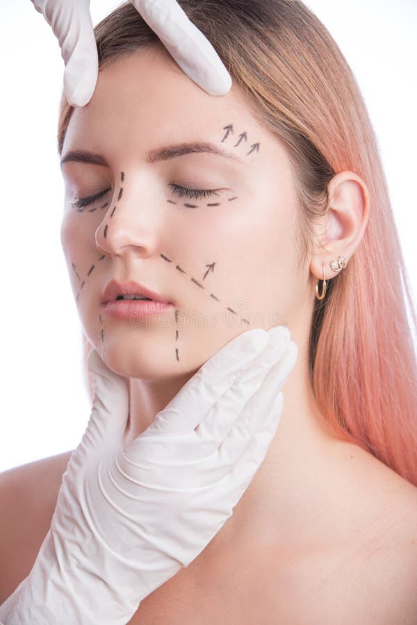 Young Pretty Girl with Perforation Lines on Face. Plastic Surgery ...