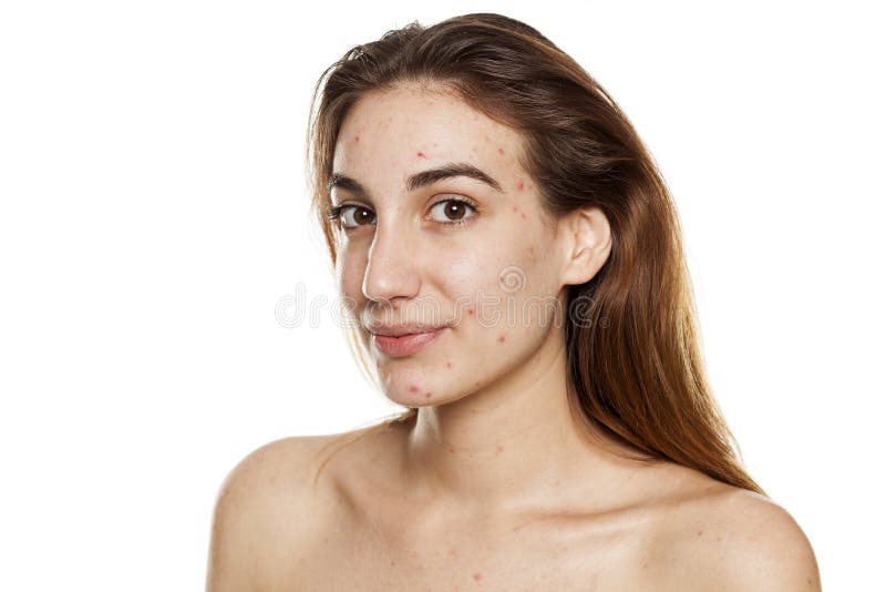 Problematic skin stock photo. Image of smile, female - 120024216