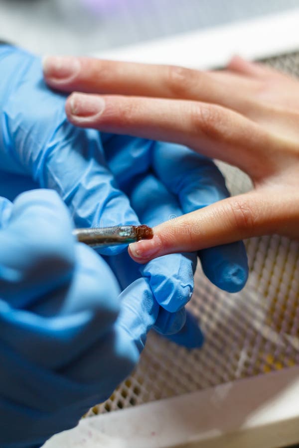 Young Woman Doing a Manicure after Panaritium Treatment Stock Image ...