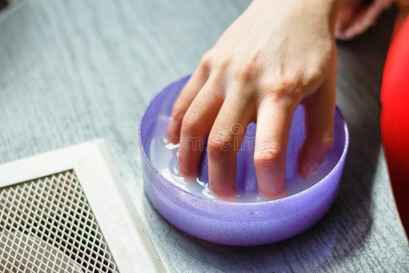 Panaritium Paronychia Stock Photos - Free & Royalty-Free Stock Photos ...