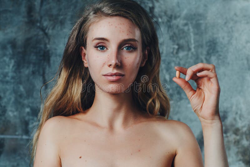 Pill to help with acne stock photo. Image of hands, model - 115394930