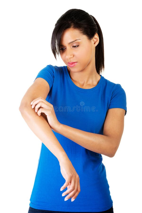 Young Woman Scratching Her Self. Stock Photo - Image of eczema ...