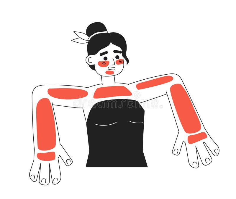 Sunburns Woman Stock Illustrations 19 Sunburns Woman Stock