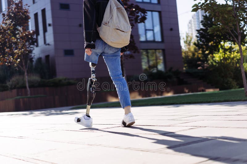 Young Woman Student with Prosthetic Leg Walking in University Campus ...