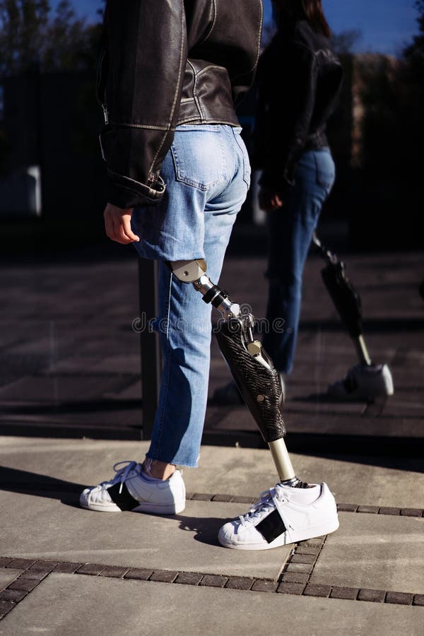 Young Woman Student with Prosthetic Leg Walking in University Campus ...
