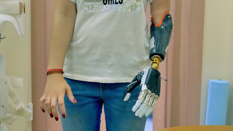 Woman with Innovative Cybernetic Bionic Arm. Disabled Woman Operates ...