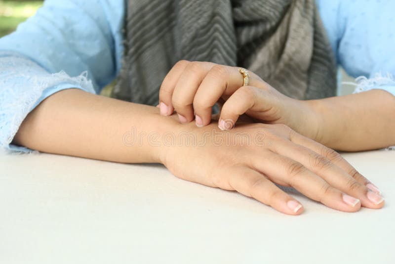 Young Women Suffering from Itching Skin Sitting on Park Stock Photo ...