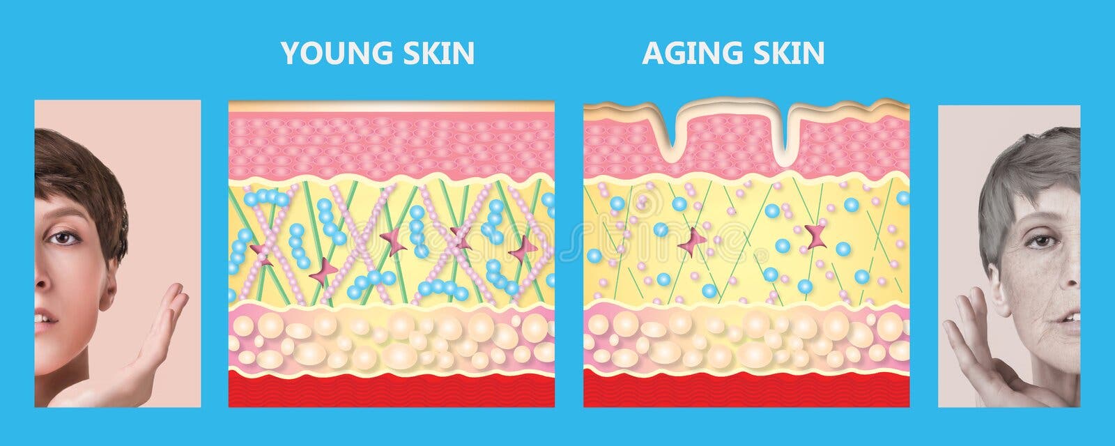 Aging Skin Folds or Skin Creases or Wrinkles at the Neck of Asian Young ...