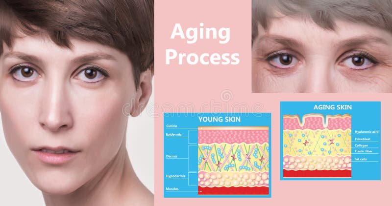 Younger Skin and Aging Skin. Elastin and Collagen Stock Photo - Image ...