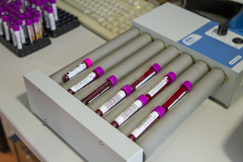 Zagreb, Croatia - June 14, 2017: Blood Sample Tubes Ready for an ...