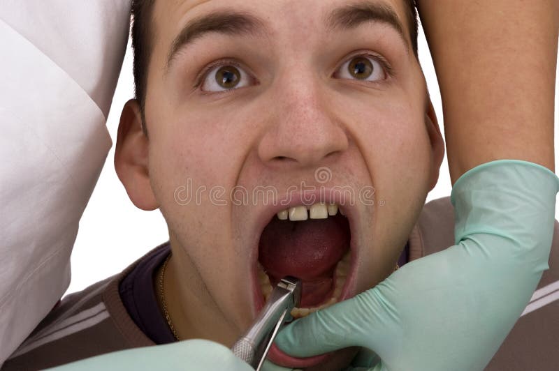 Zahnmedizinische Extraktion Stockbild - Bild von schmerz, disziplin ...