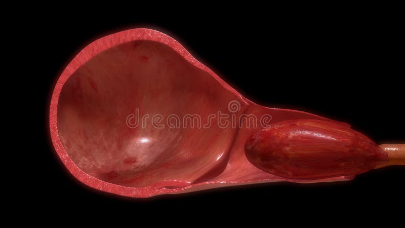 Ziehen Der Plazenta Aus Gebärmutter Heraus Stockfoto - Bild von kind ...