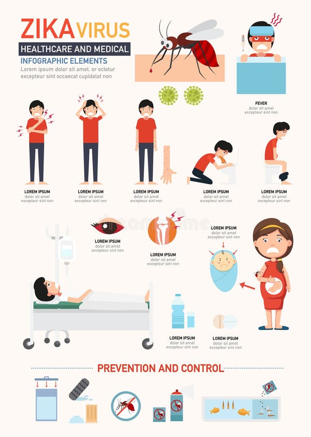 Zika Virus Infographics.vector Stock Vector - Illustration of fever ...