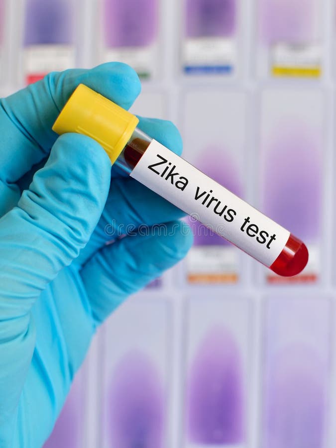 Zika virus testing stock image. Image of headaches, myalgia - 66172177