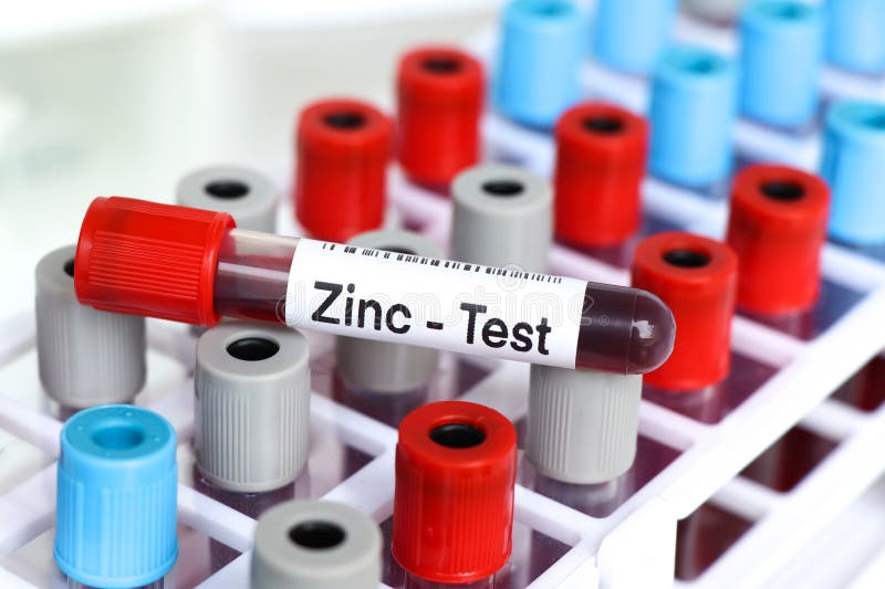 Zinc Test, Blood Sample To Analyze in the Laboratory Stock Photo ...