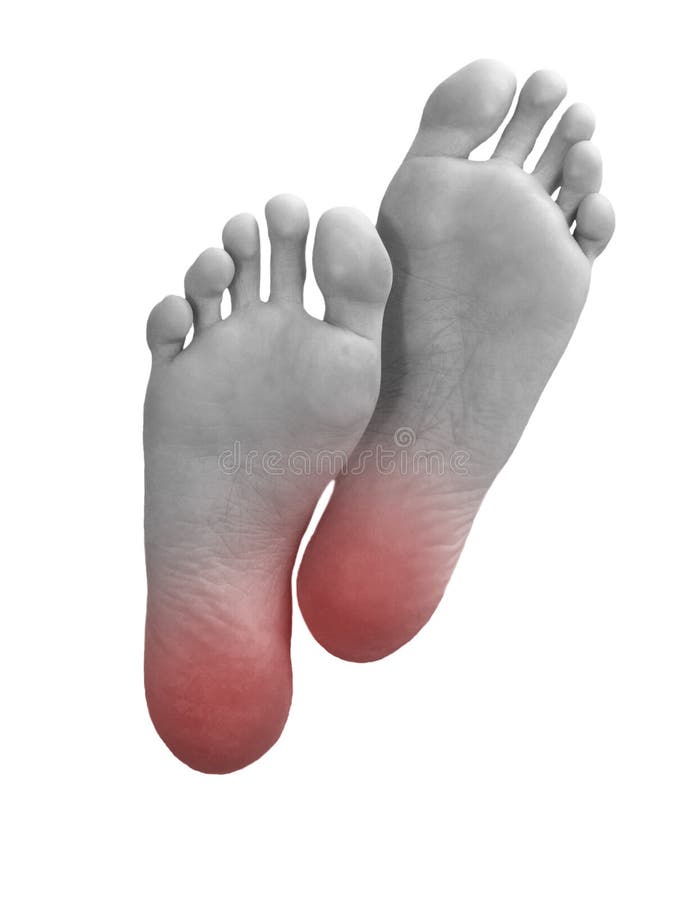 Zool Van De Voet Met Rode Beschadigde Punten Stock Afbeelding - Image ...