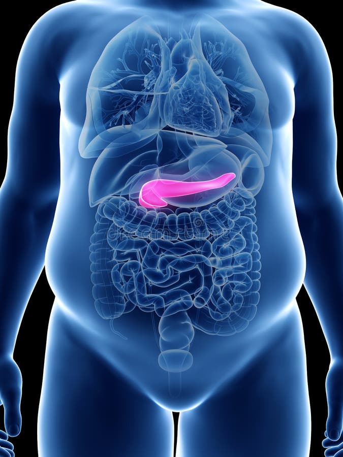 Alvleesklierkanker stock illustratie. Illustration of zwaarlijvig ...