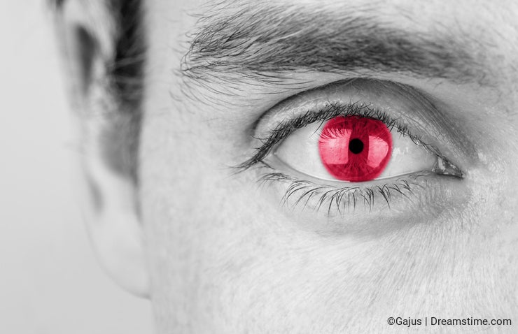 How to Remove Red Eye - Dreamstime