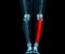 3D Render of Lower Extremity or Legs Isolated on Black Background Stock ...