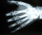 Hand x-ray stock image. Image of technology, radiology - 411153