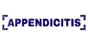 Appendicitis stock vector. Illustration of obstruction - 45231571