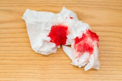 Bloody Tissue Stock Images - Download 116 Royalty Free Photos